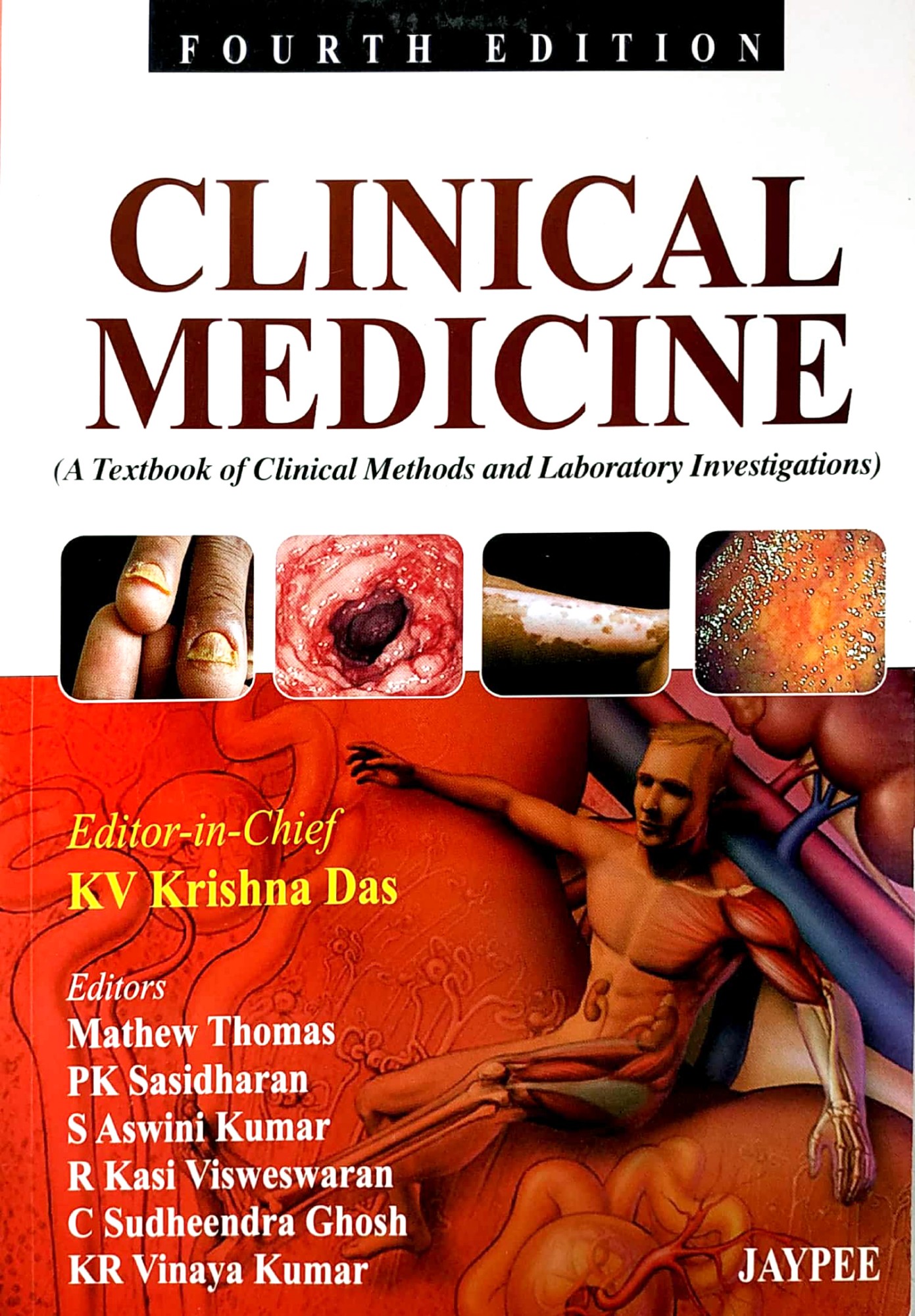 Clinical Medicine | A Textbook of Clinical Methods and Laboratory ...
